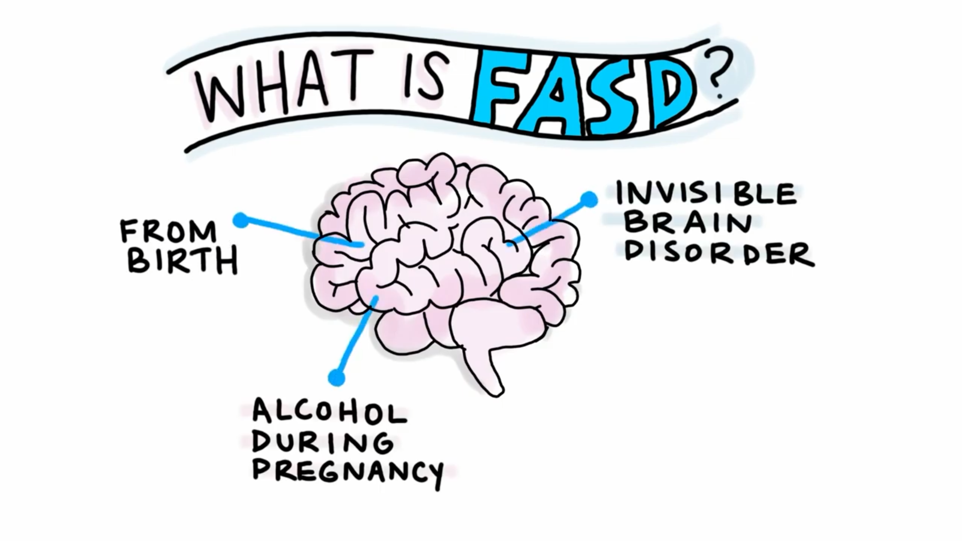 What are Fetal Alcohol Spectrum Disorders (FASD)? – The Lussier Lab